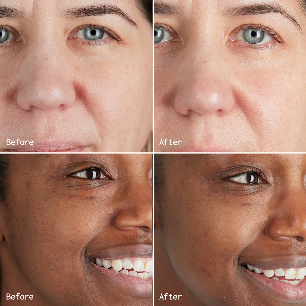 Liquid Brilliance™ Super Serum