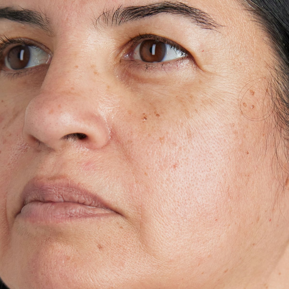 Expert Regimens for Hyperpigmented Skin | Save 10%