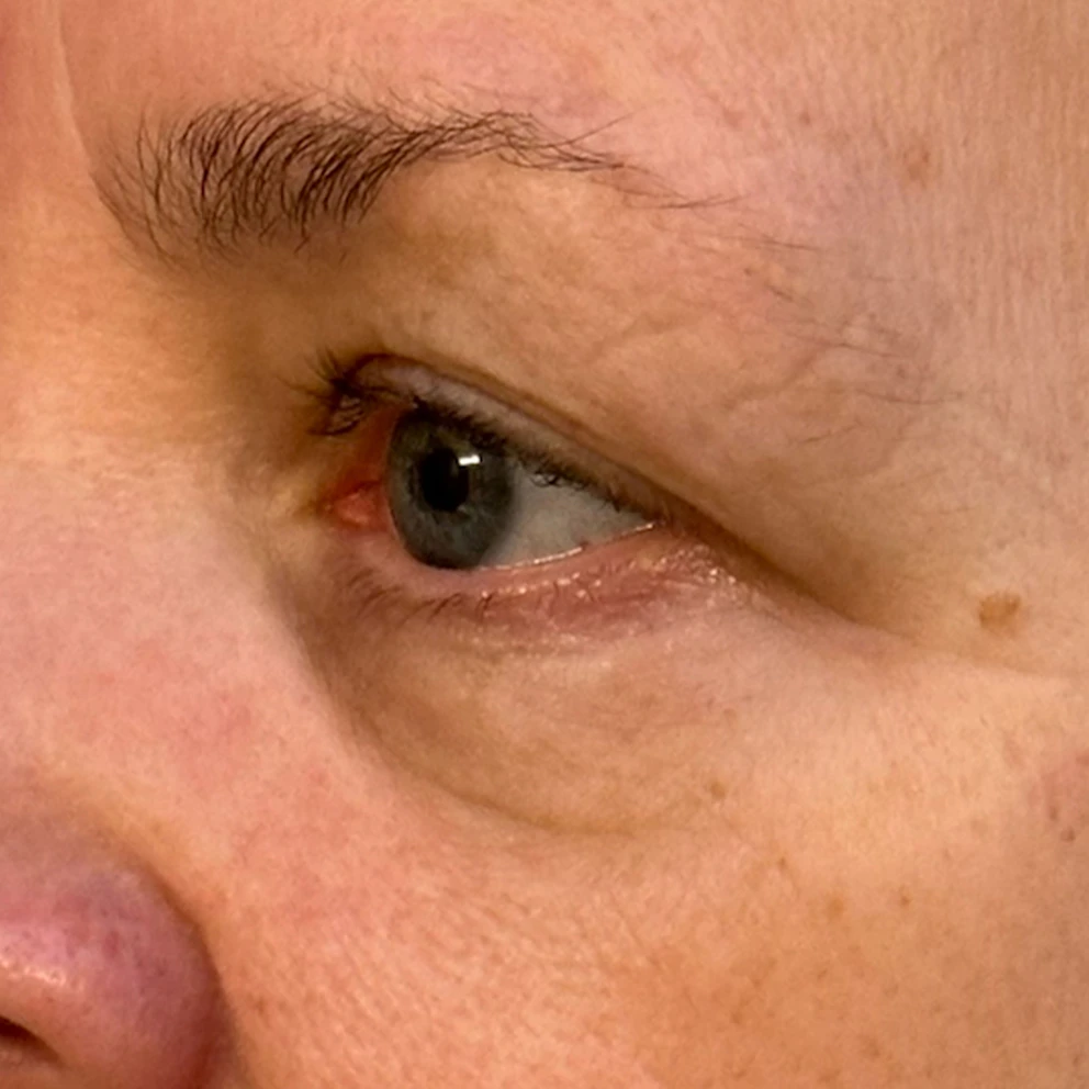 Expert Regimens for Fine Lines + Wrinkles | Save 10%